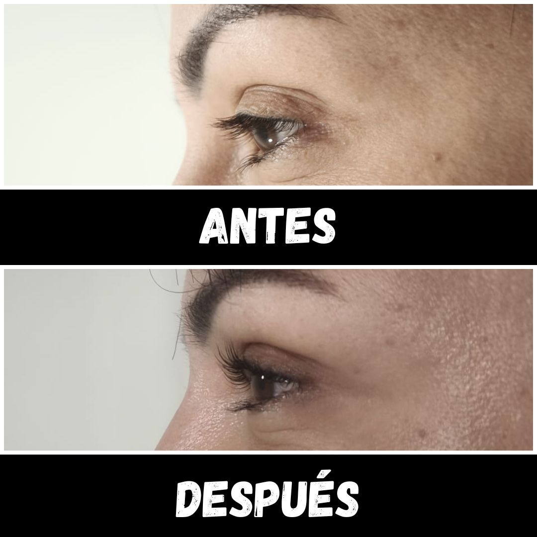 Lifting de Pestañas: Realza tu Mirada Naturalmente en Sabadell – ARCANA ...